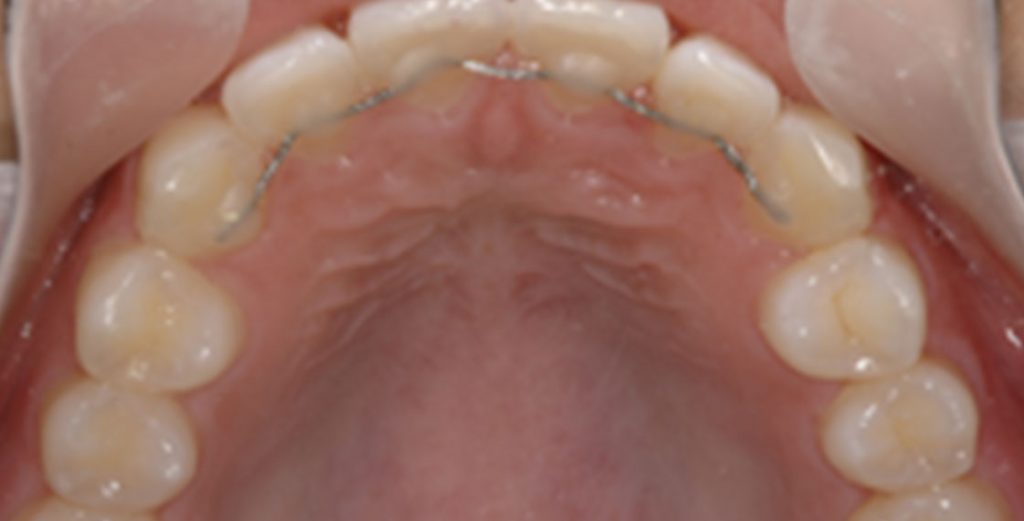 EHBO | Orthodontisten Onderweg