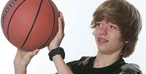 Retentiebeugels | Orthodontisten Onderweg